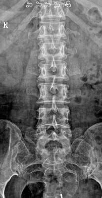 PLX8500 Series Multifunctional Dynamic Digital radiography – Kadrimed ...